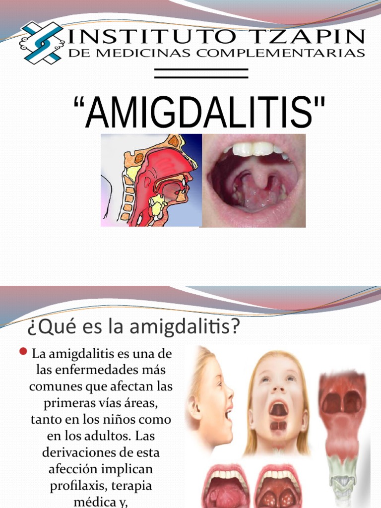 Amigdalitis | PDF | Penicilina | Enfermedades y trastornos
