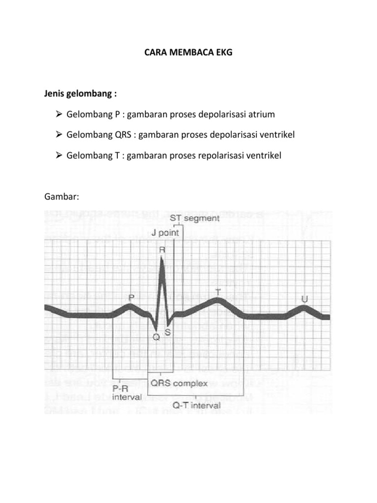Cara Membaca Ekg | PDF