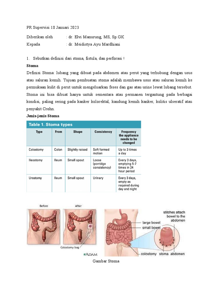 Stoma, Fistula, Perforasi | PDF