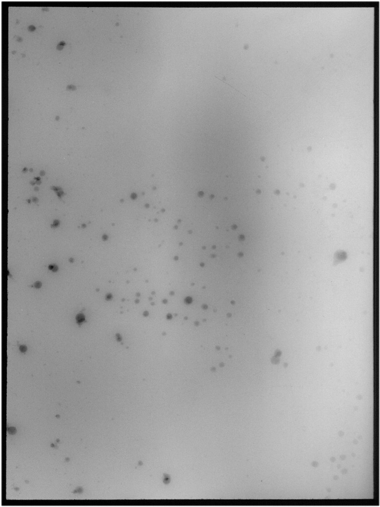 ASTM E446 A - Gas Porosity Level 4 | PDF
