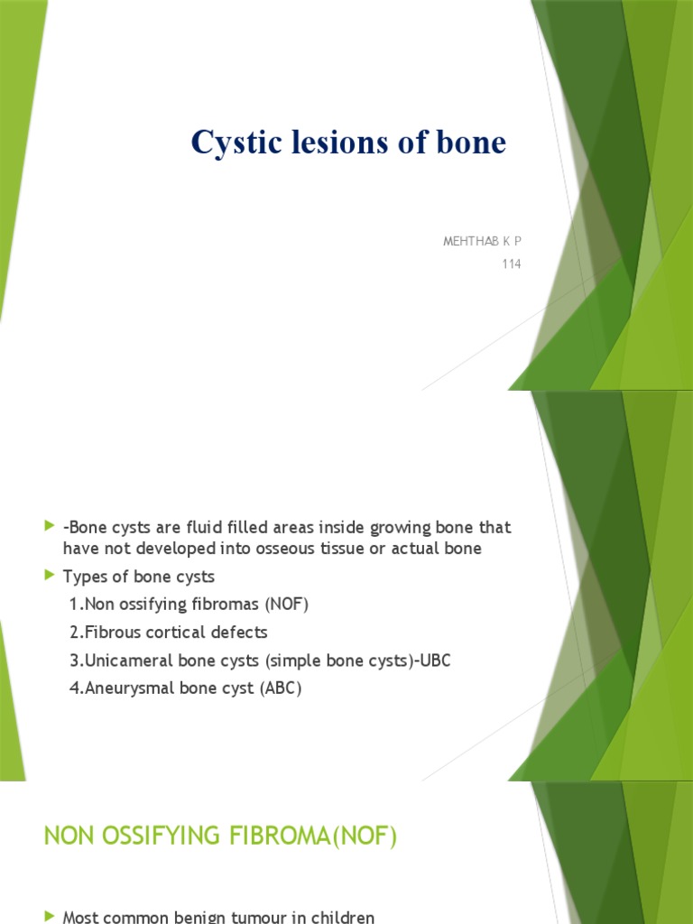 Cystic Bone Lesions Overview | PDF | Science & Mathematics