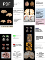Sistema Hexaxial de Bailey | PDF | Electrocardiografia | Corazón