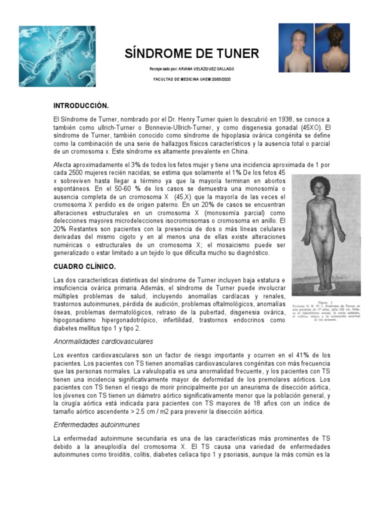 SÍNDROME DE TUNER | PDF | Medicina CLINICA | Causas de la muerte