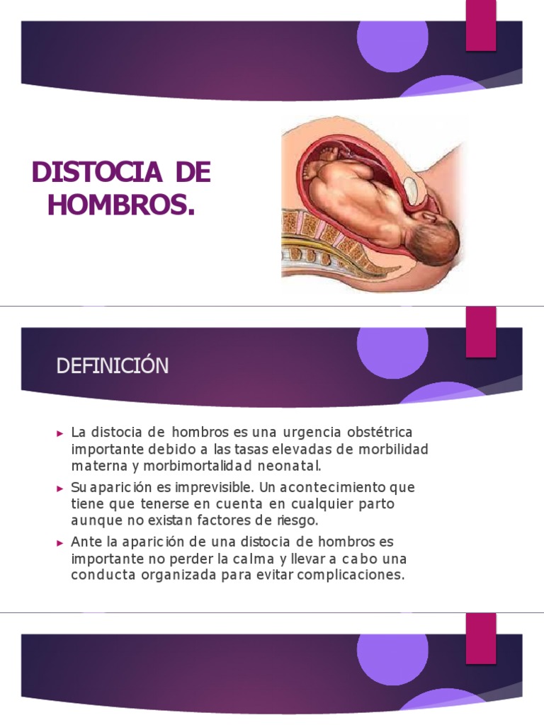 Manejo de la Distocia de Hombros | PDF | Parto | Hombro