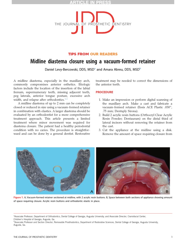Midline Diastema Closure Using A Vacuum-Formed Retainer | PDF ...