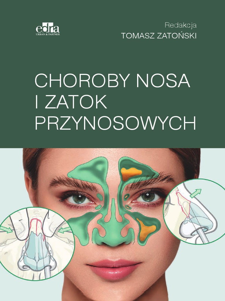 Choroby Nosa | PDF