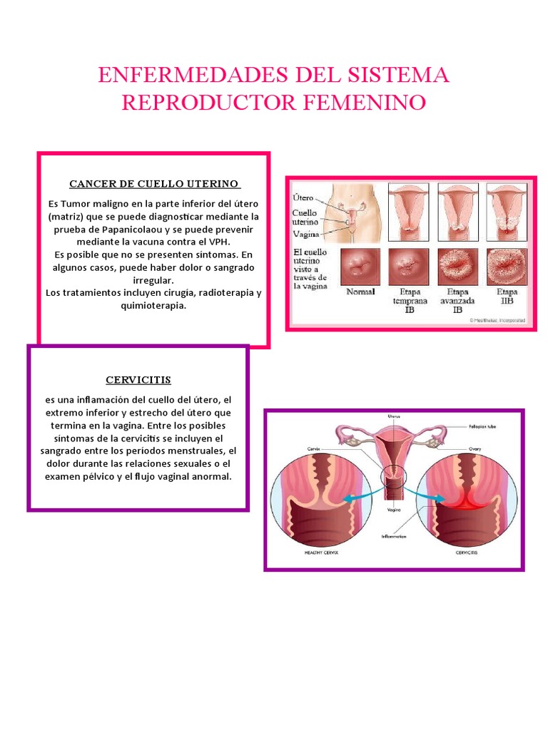 Enfermedades Reproductivas: Causas y Tratamientos | PDF