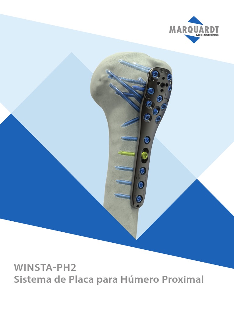 Winsta-Ph2 Sistema de Placa para Húmero Proximal: Medizintechnik | PDF