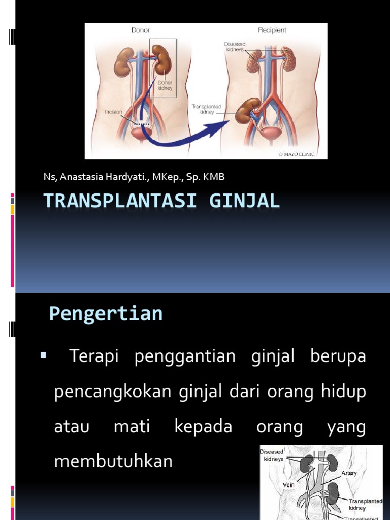 Transplantasi Ginjal | PDF | Kesehatan Holistik | Sains & Matematika