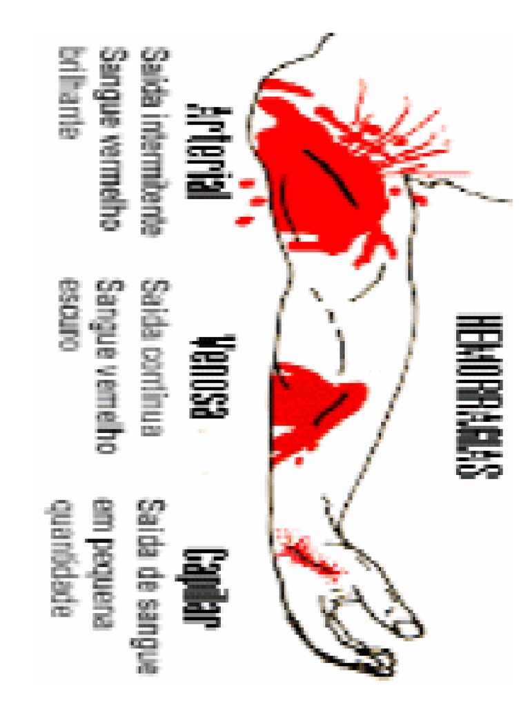 Tipos de hemorragia: suas causas, sinais e primeiros socorros | PDF ...