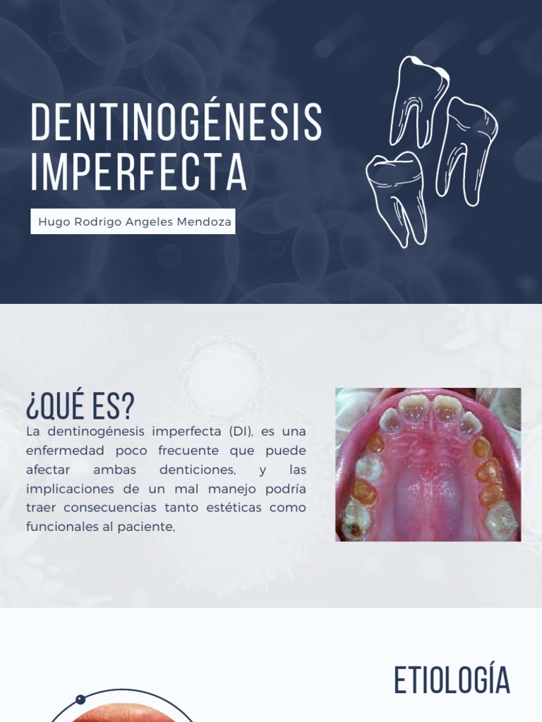 Dentinogenesis Imperfecta | PDF | Especialidades Medicas | Causas de la muerte