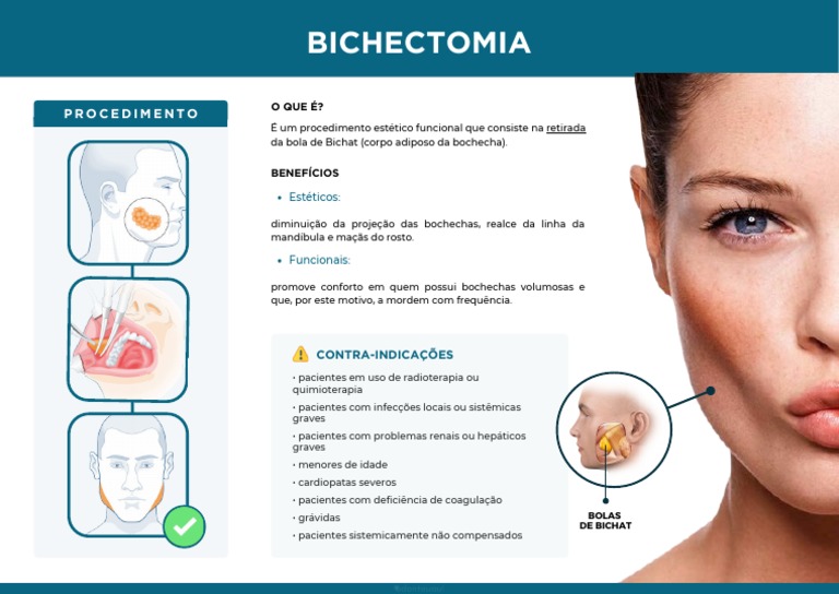 Bichectomia | PDF