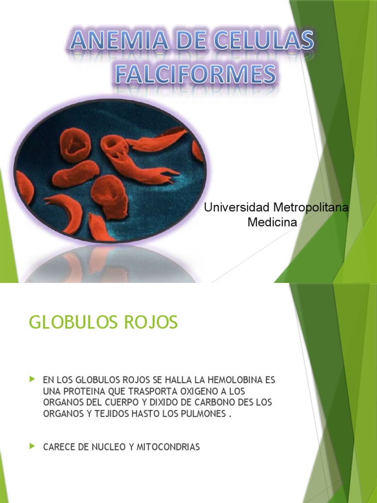 Anemia de Celulas Falciformes Yule | PDF | Glóbulo rojo | Hemoglobina