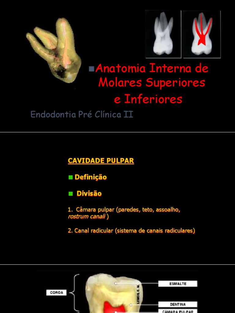Anatomia Interna de Molares Superiores e Inferiores PDF | PDF