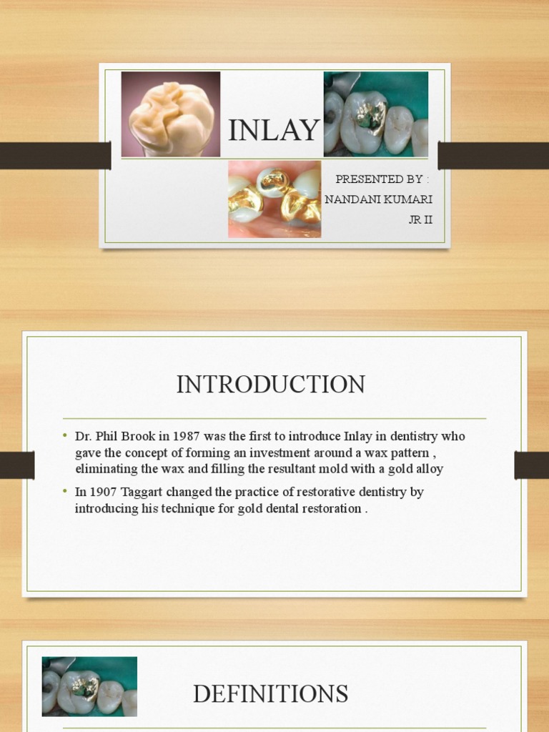 Dental Inlays: Techniques and Guidelines | PDF | Dental Composite ...