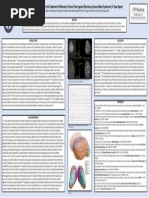 Interdigital (Morton's) Neuroma - Foot & Ankle - Orthobullets | PDF ...