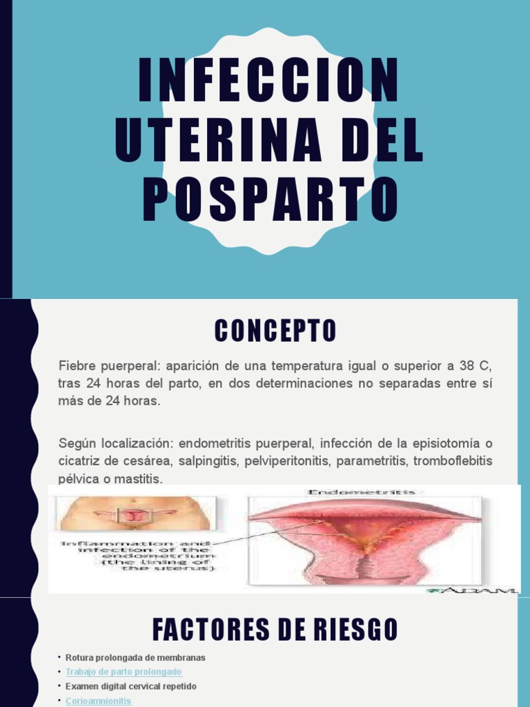 INFECCION UTERINA DEL POSPARTO Completo | PDF | Periodo posparto ...
