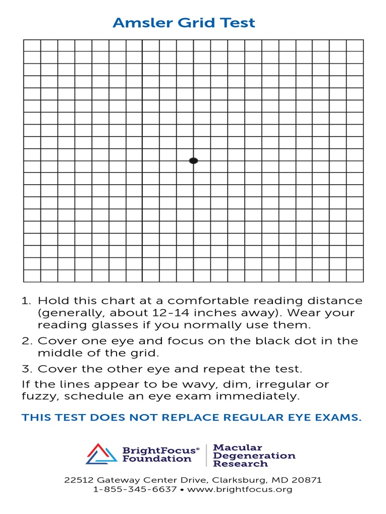 Amsler Grid Test Instructions | PDF