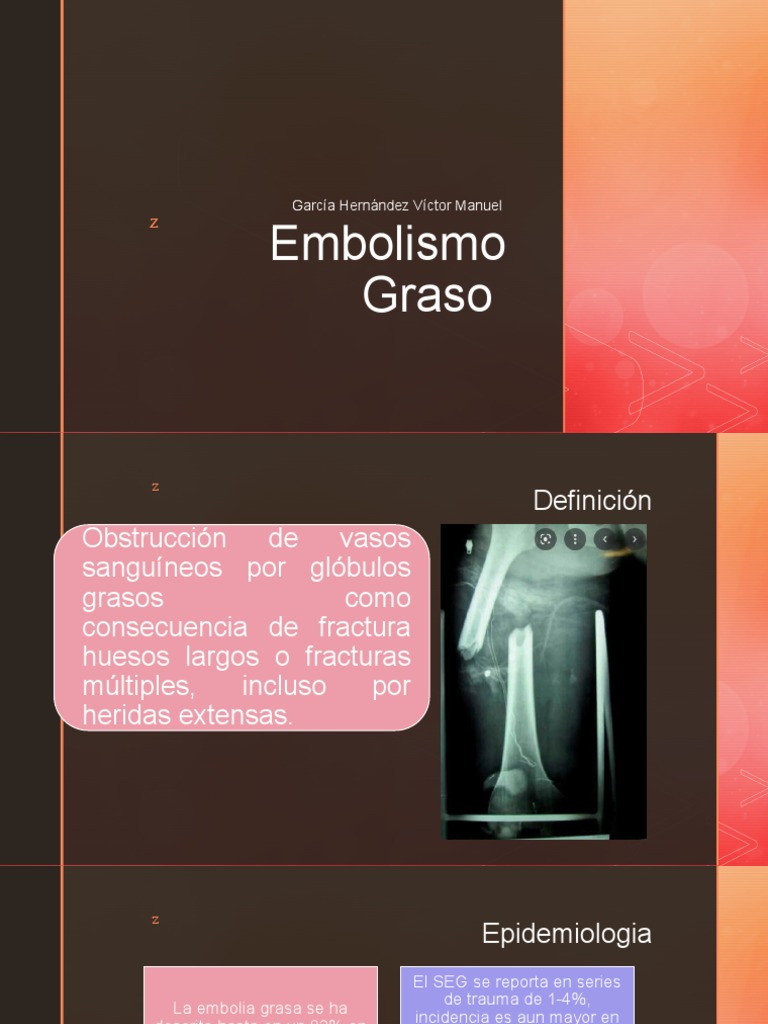 Embolismo Graso Pdf Embolia Medicina Clinica