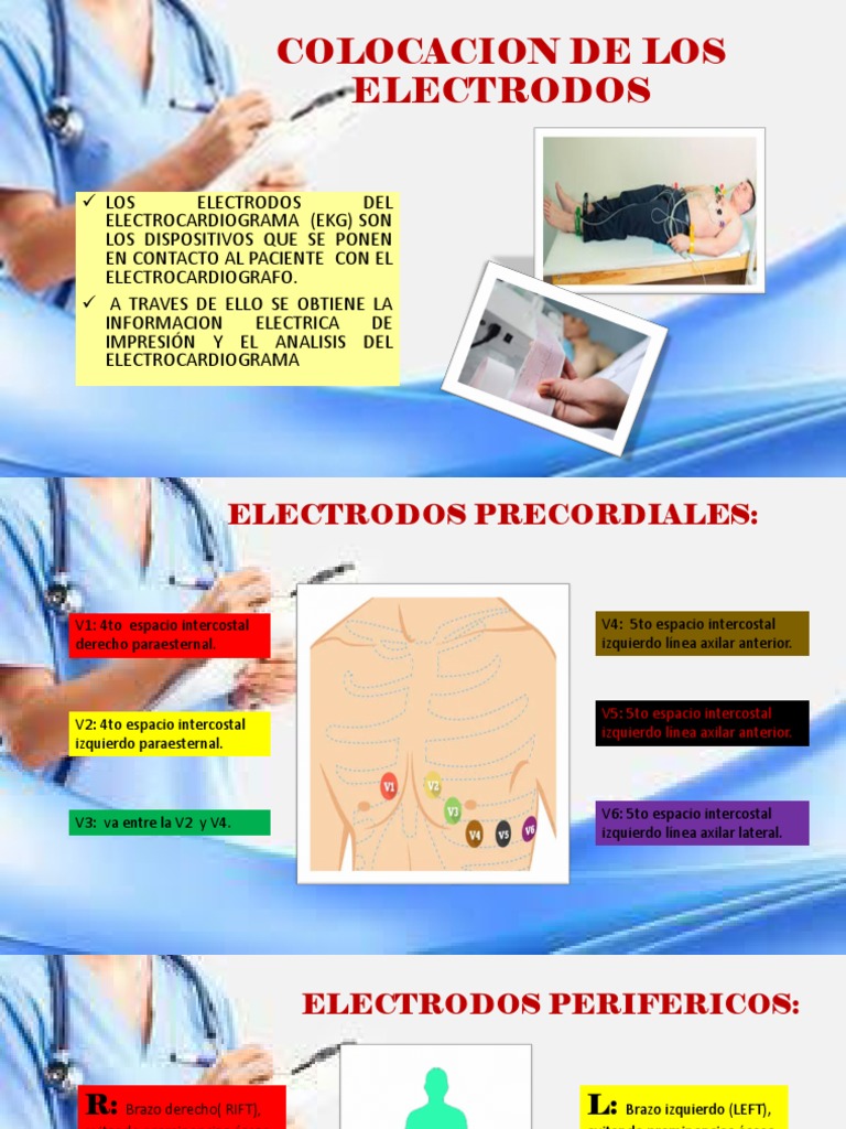 Colocación de Electrodos | PDF