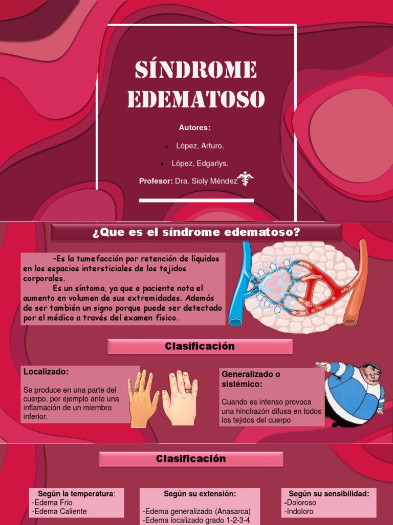 Clasificación y tipos de edema | PDF | Edema | Enfermedades y trastornos