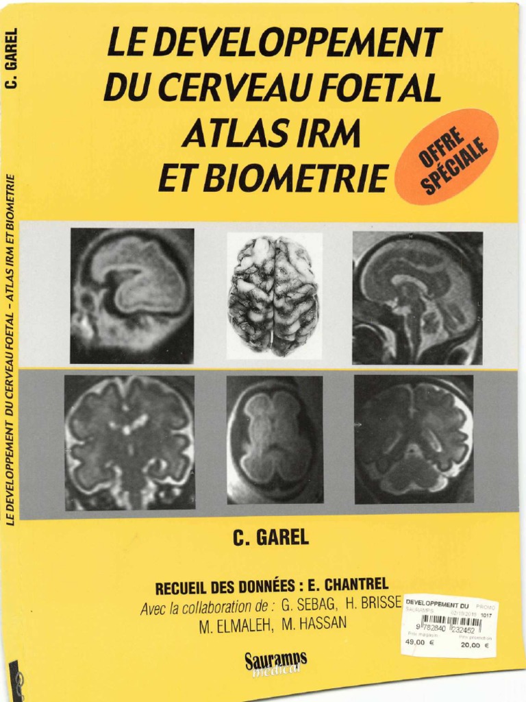 Le Développement Du Cerveau Foetal - Atlas IRM Et Biométrie (2000) | PDF