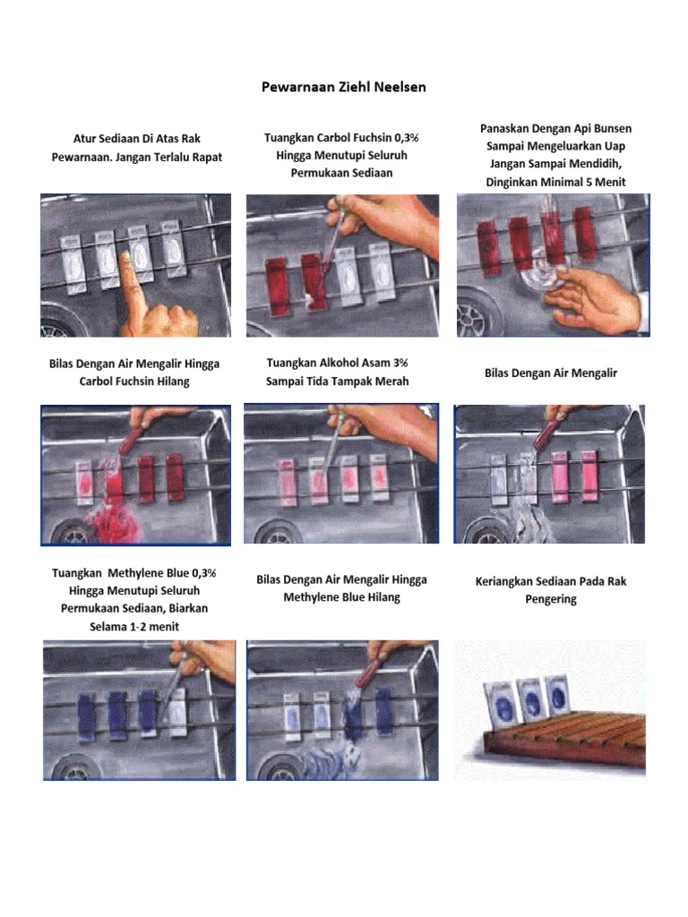 Pewarnaa Ziehl Neelsen | PDF