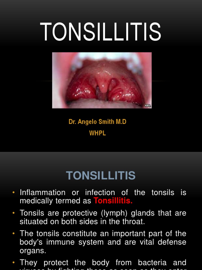 Tonsillitis | PDF | Epidemiology | Causes Of Death