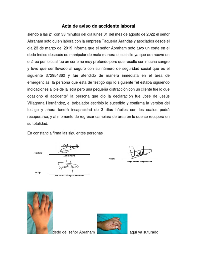 Acta de Aviso de Accidente Laboral | PDF