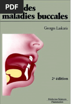 Leucoplasie Poilue Buccale