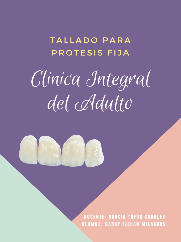 Tallado Dental para Prótesis Fija | PDF | Dentadura postiza | Odontología