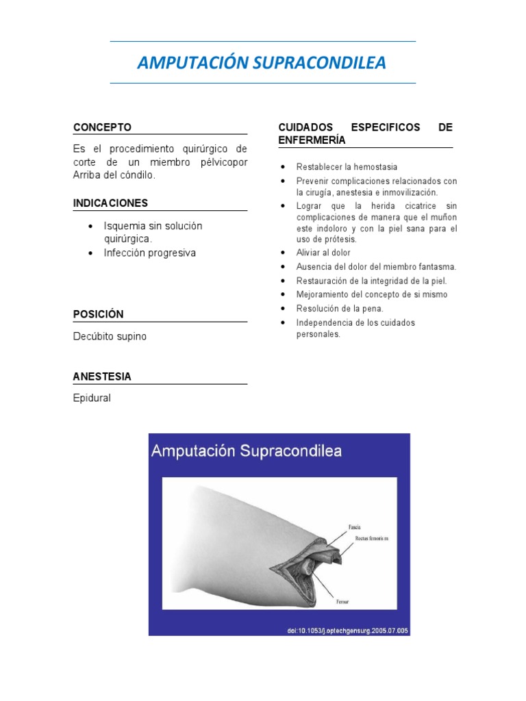 AMPUTACION SUPRACONDILEA | PDF | Sistema musculoesquelético | Medicina