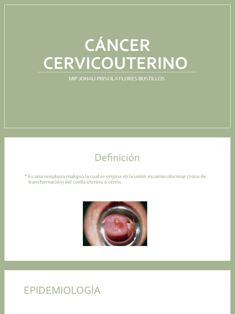Cancer Cervicouterino | Descargar gratis PDF | Cáncer | Especialidades Medicas