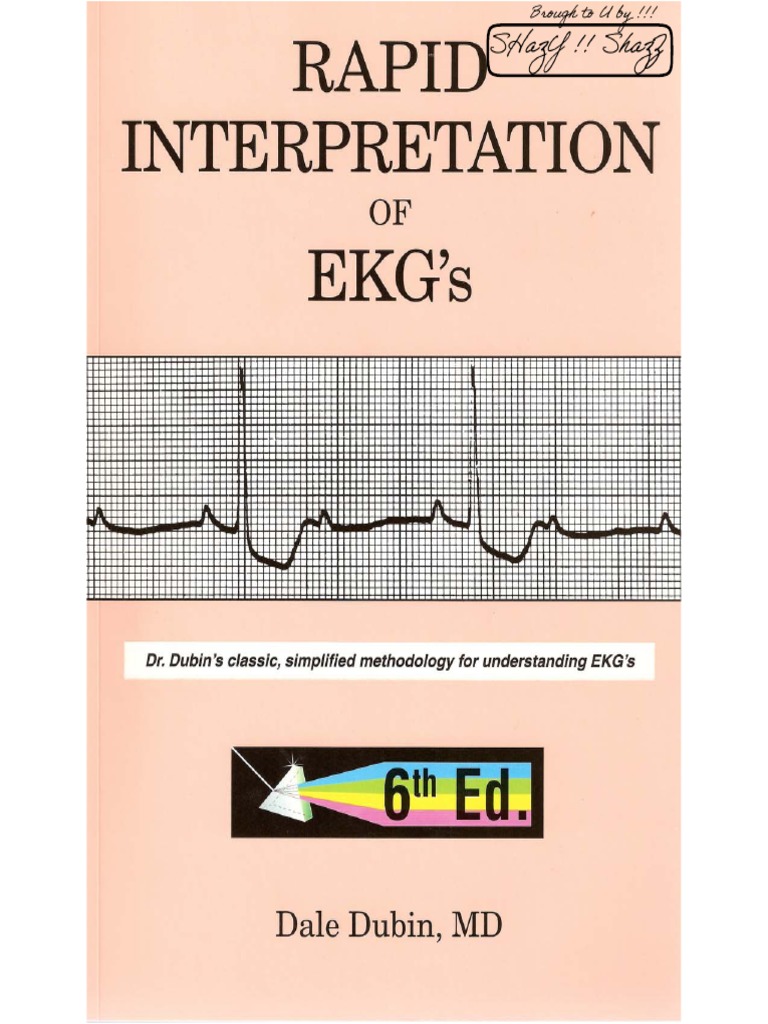 Rapid Interpretation of EKG | PDF