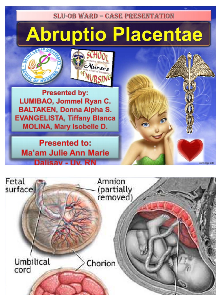 Abruptio Placentae (Case Presentation) | PDF | Placenta | Intravenous Therapy