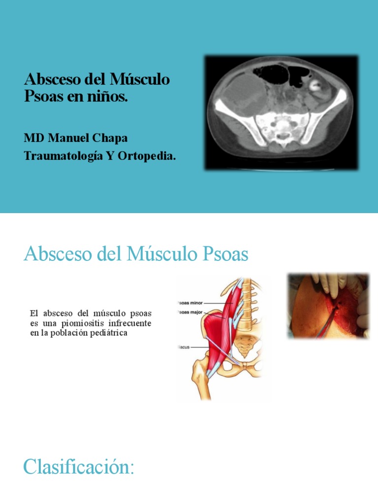 Absceso del Psoas en Niños: Diagnóstico y Síntomas | PDF