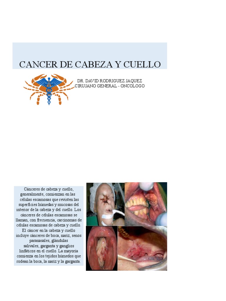 Cáncer de Cabeza y Cuello | PDF | Cáncer | Enfermedades y trastornos