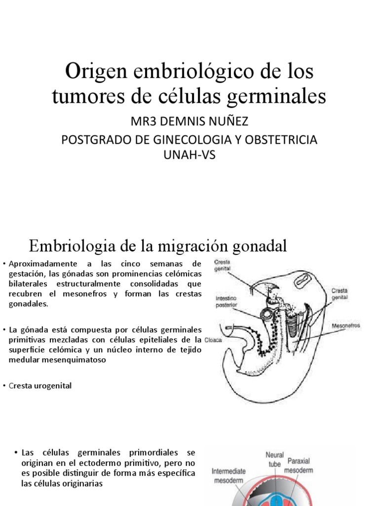 Origen Embriologico de Los Tumores de Celulas Germinales | PDF | Ovario | Neoplasias