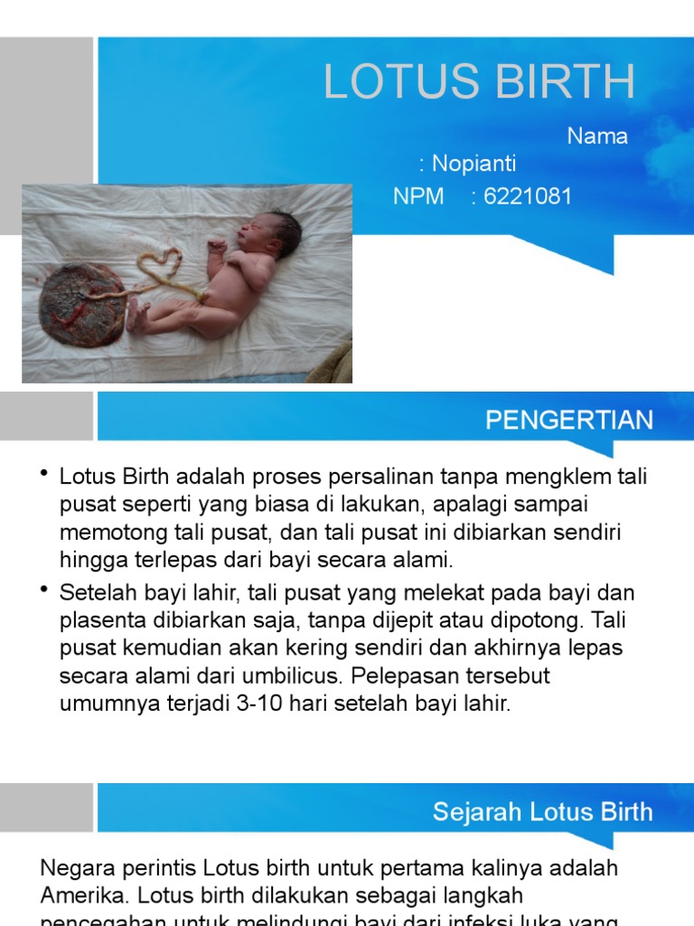 Lotus Birth | PDF