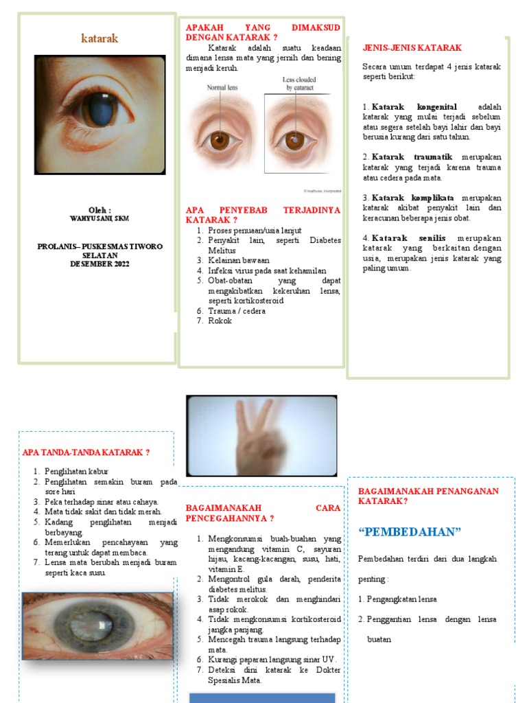 Leaflet Katarak 25 | PDF