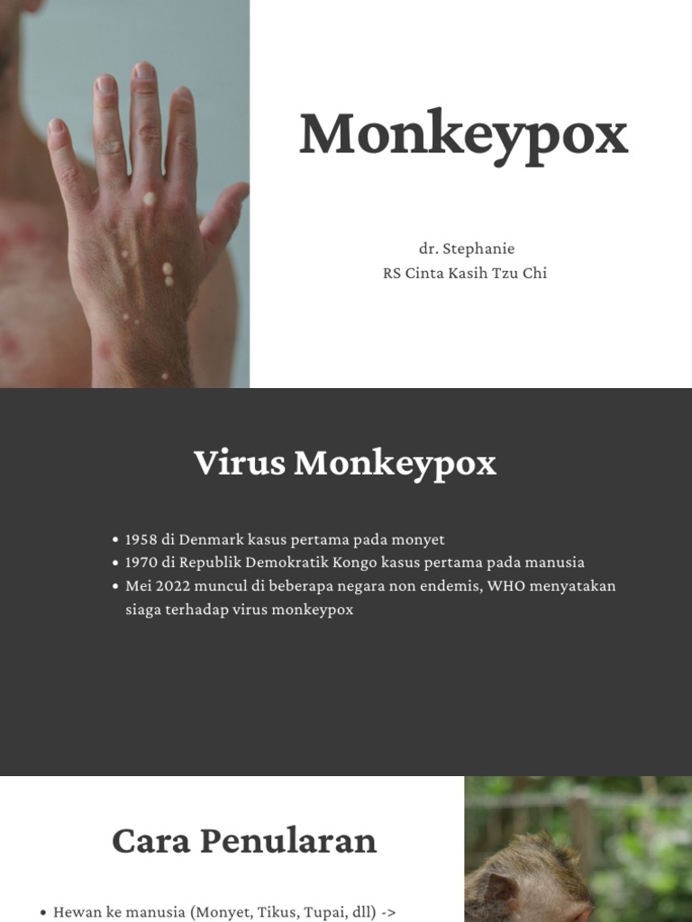 Monkeypox | PDF | Kesehatan Holistik