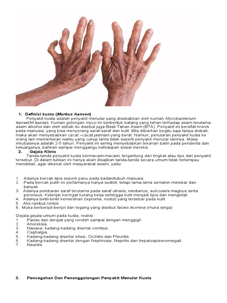 Panduan Lengkap Kusta: Gejala, Pencegahan, dan Penanggulangan | PDF