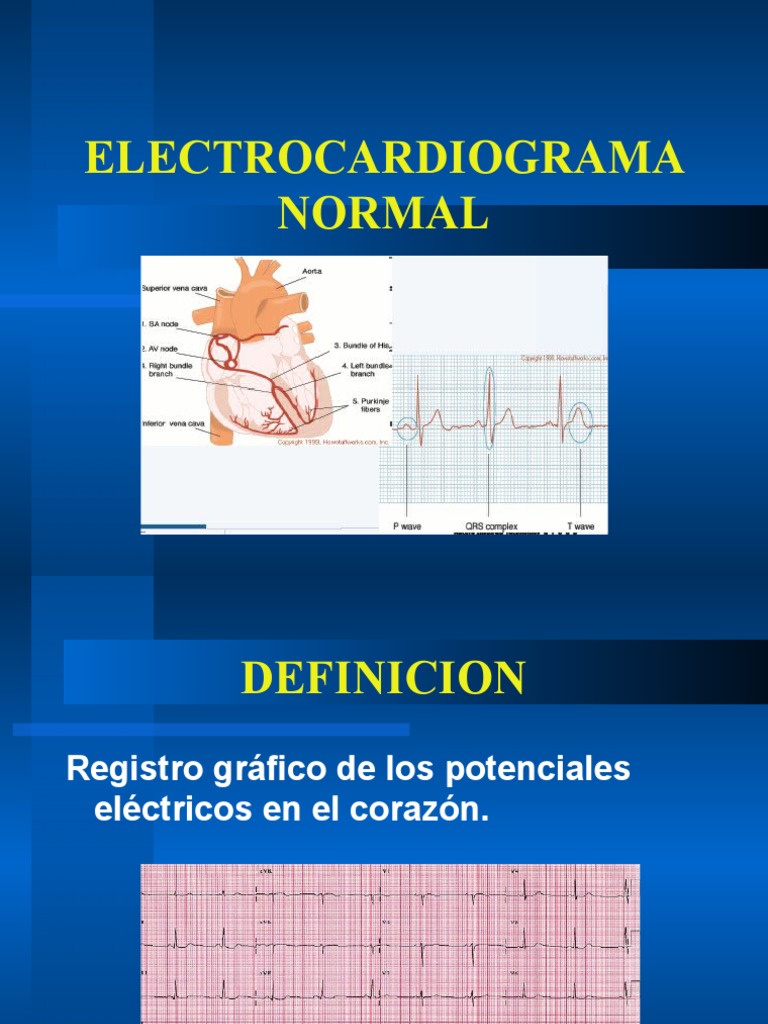 Electrocardiograma Normal | PDF | Electrocardiografia | Sistema ...