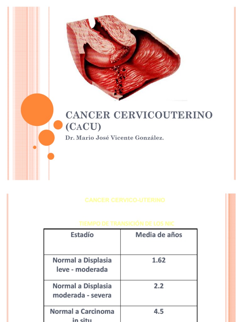 Cancer Cervicouterino (Cacu) | PDF | Cáncer de cuello uterino | Útero
