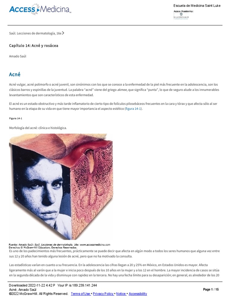 Acné | PDF | Especialidades Medicas | Medicina CLINICA