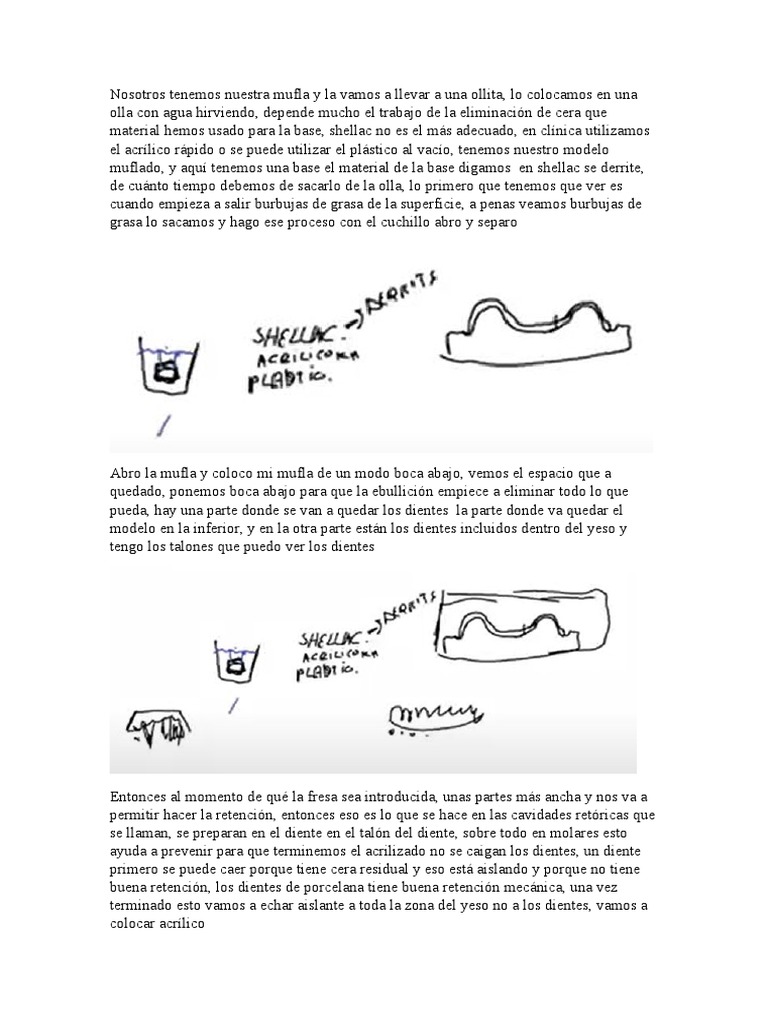 Mufla, Acrilizado y Pulido | PDF | Dentadura postiza