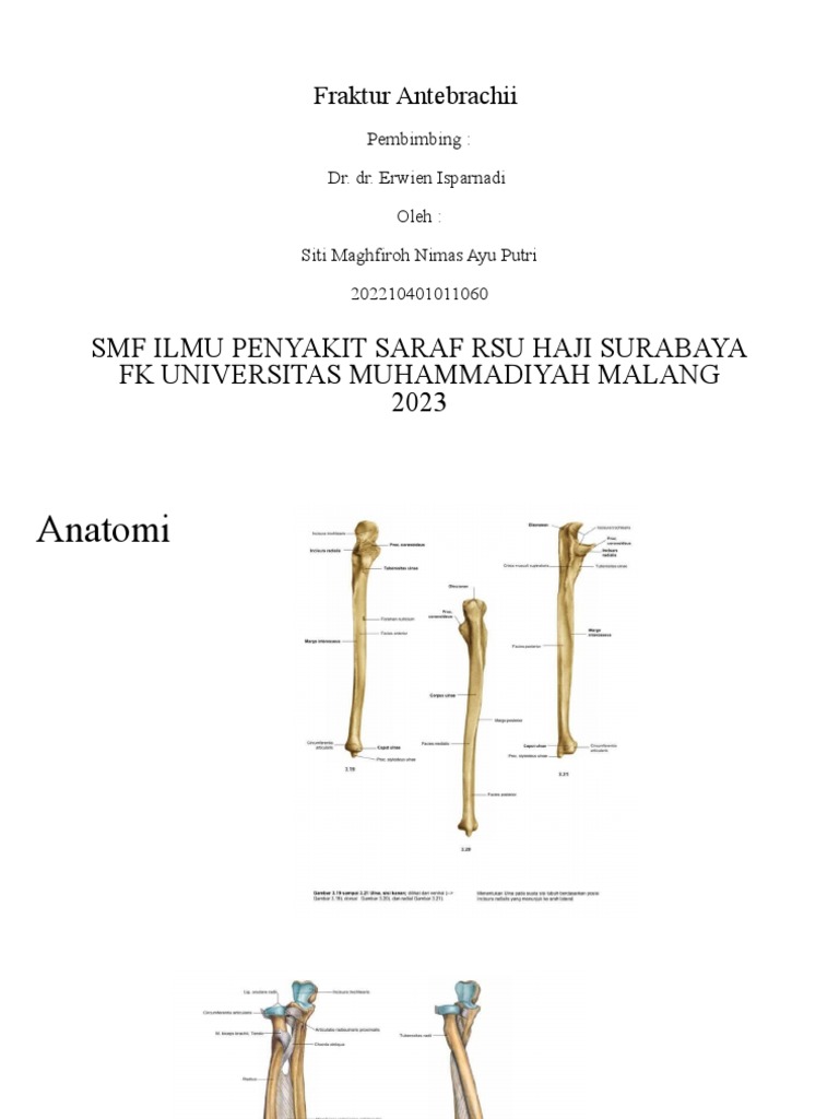 Fraktur Antebrachii: Panduan Medis | PDF