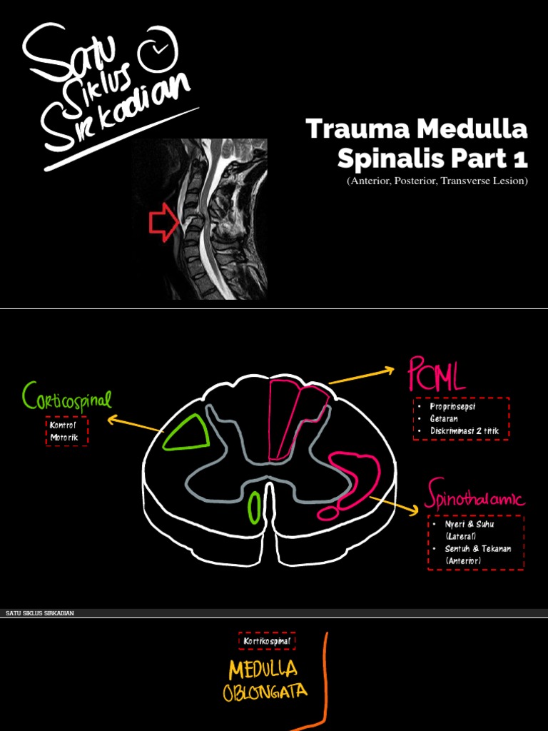 Trauma Medulla Spinalis (Satu Siklus Sirkadian) | PDF
