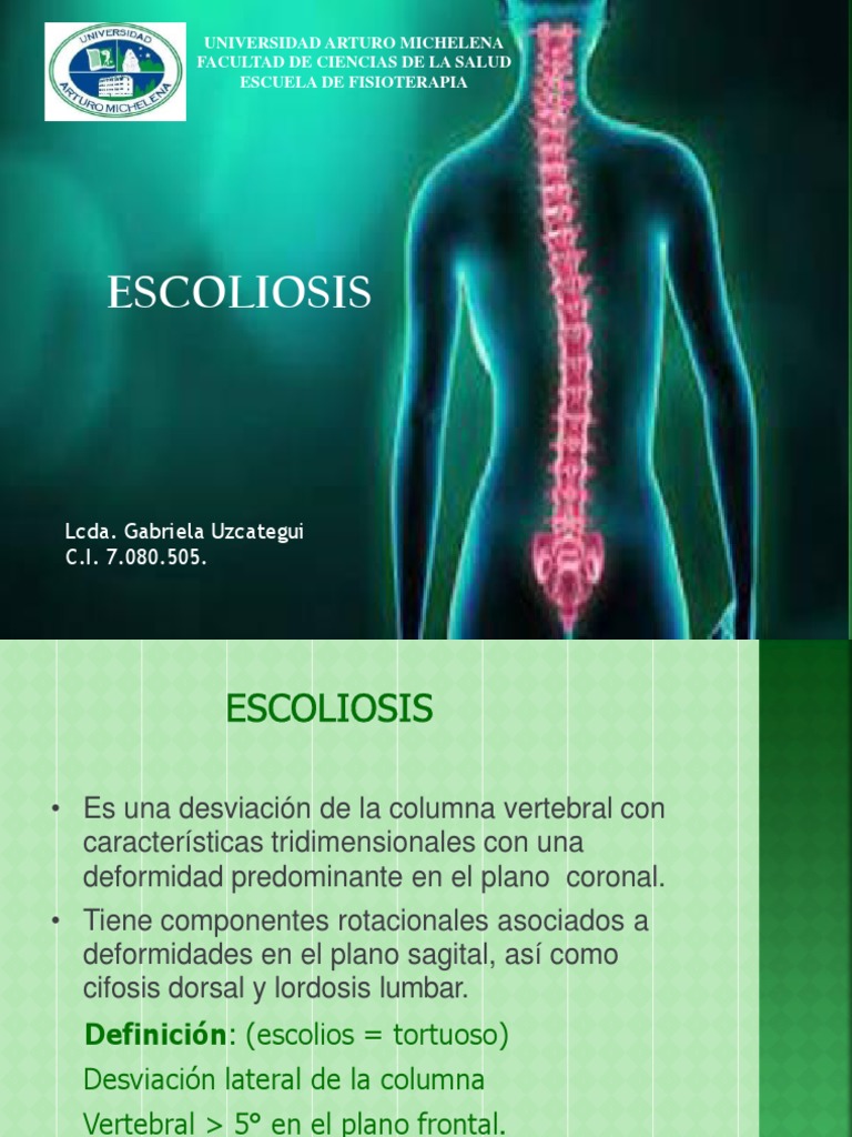 Clase 3 Escoliosis | PDF | Escoliosis | La columna vertebral
