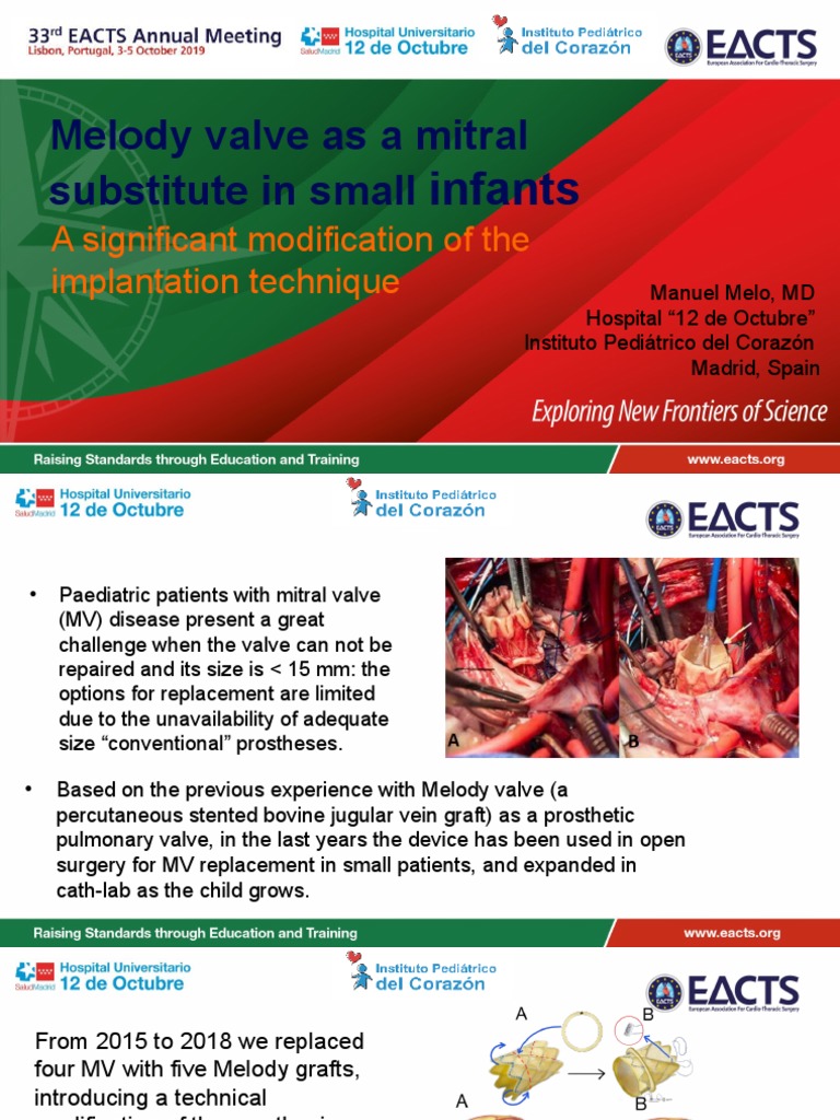 Modification of Melody Valve Implantation Technique Provides Improved ...